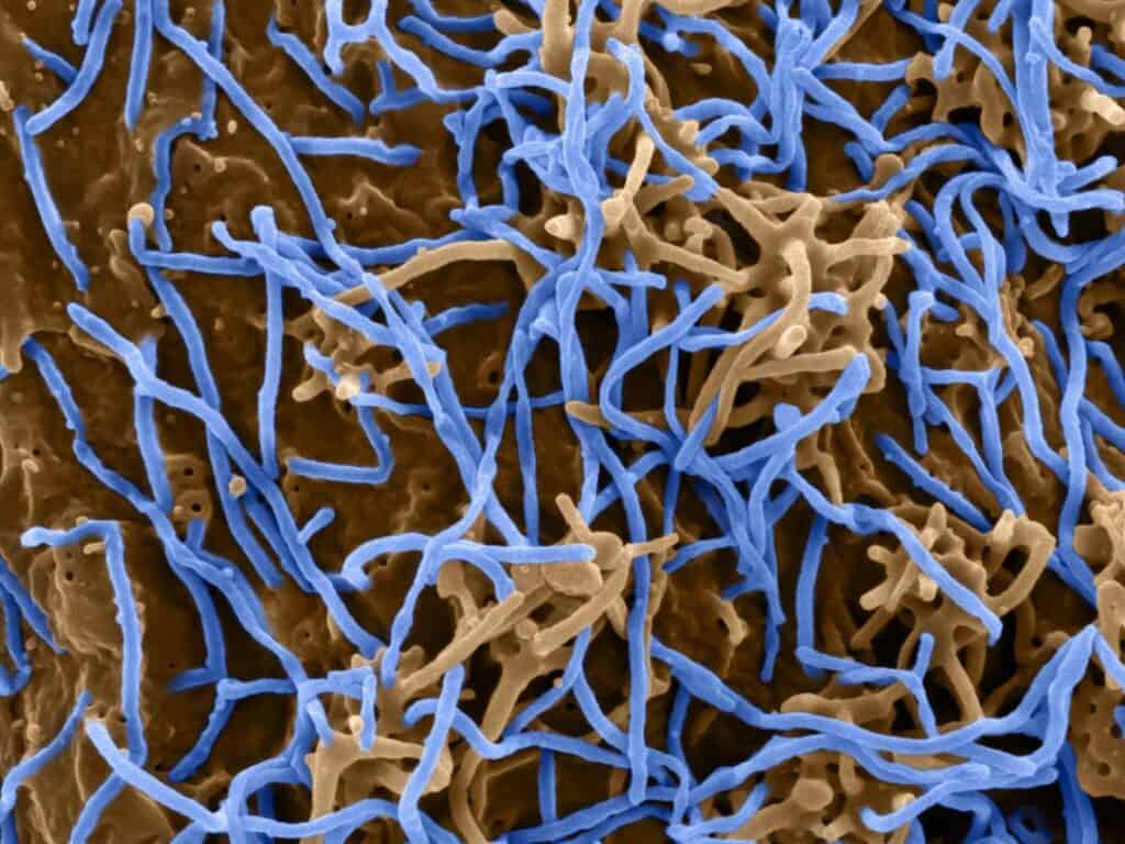 18 Deadliest Diseases Recorded in History